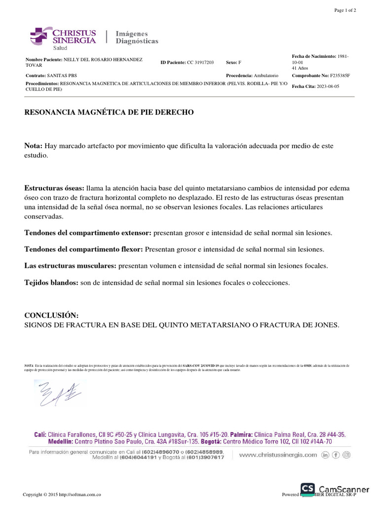 Informe Diagnostico | PDF | Rodilla | Imagen de resonancia magnética