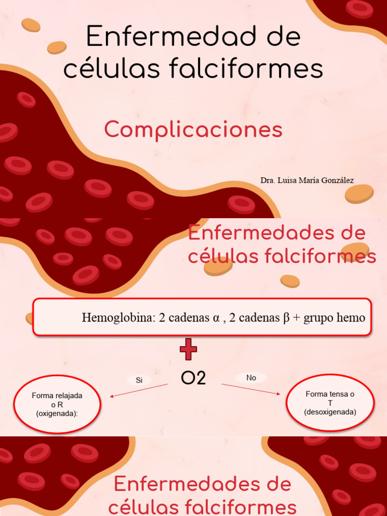Complicaciones Falcemia | PDF | Isquemia | Enfermedades y trastornos