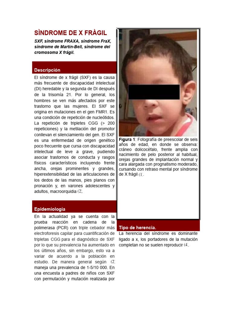 Síndrome de X Frágil: Características y Diagnóstico | PDF | Genética ...
