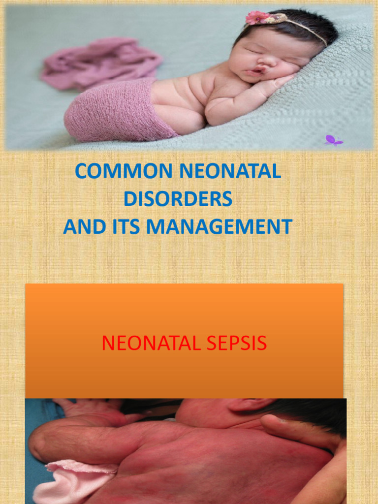 Common Neonatal Disorders 5 | PDF | Sepsis | Infants