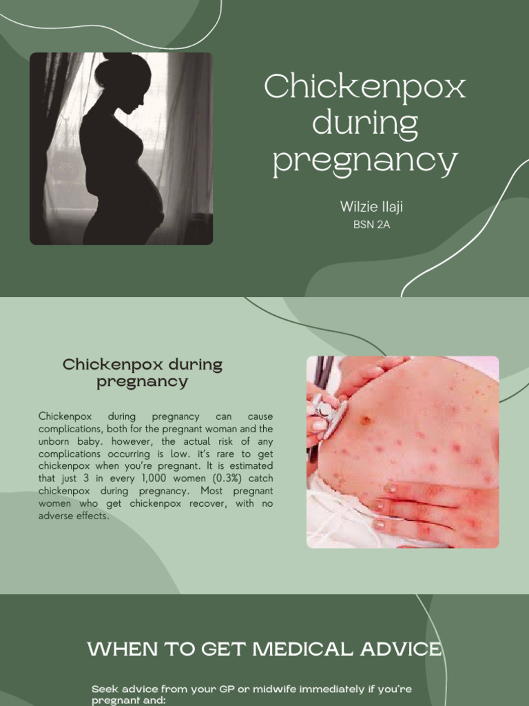 Chickenpox During Pregnancy | PDF | Pregnancy | Medical Specialties