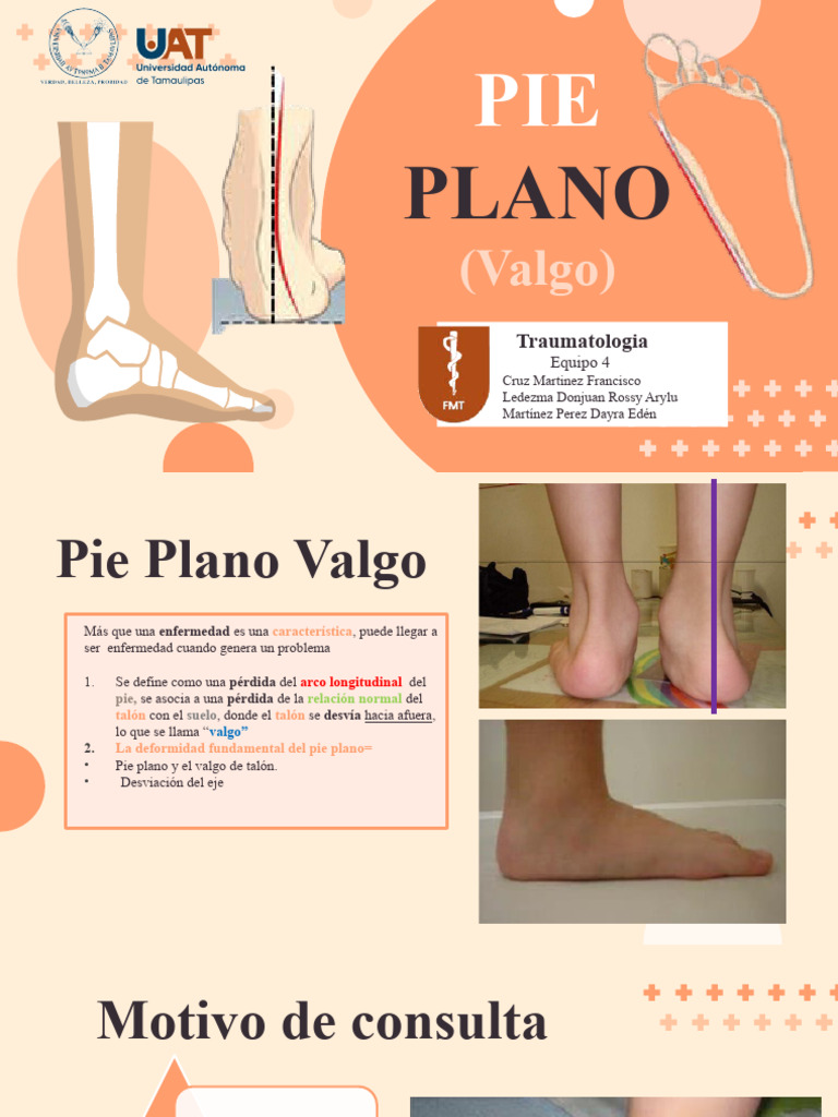 Traumatologia Pie Plano (Valgo) | Descargar gratis PDF | Pie | Sistema ...