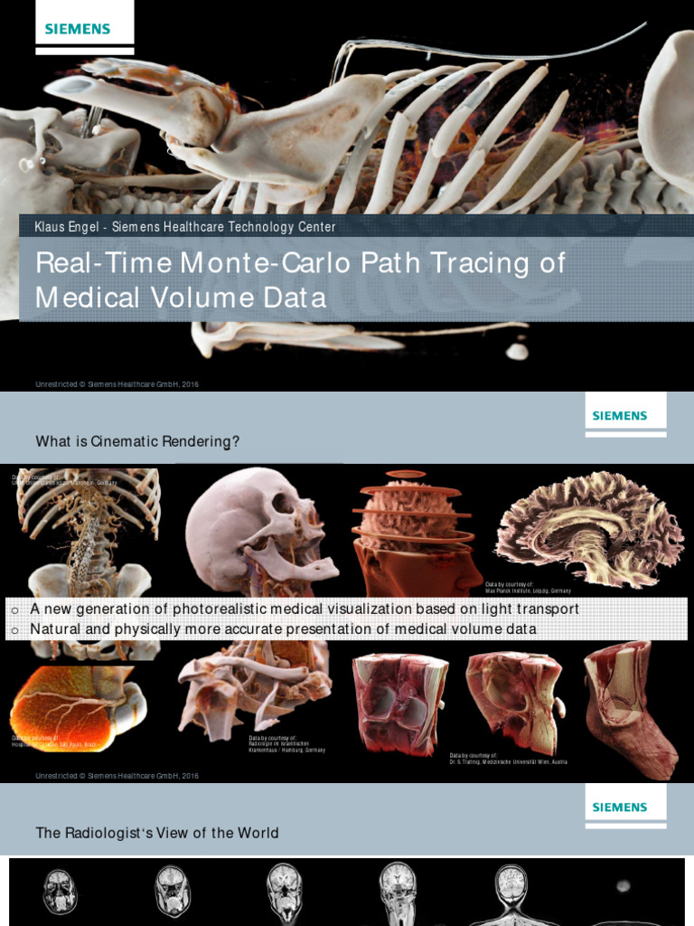 s6535 Klaus Engel Real Time Monte Carlo Path Tracing Medical Volume Data | PDF