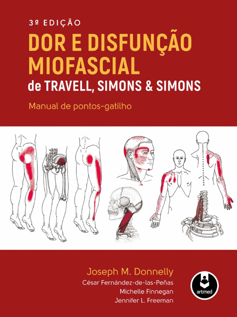 Dor E Disfunção Miofascial De Travell 3ª Edição PESQUISÁVEL | PDF | Dor ...