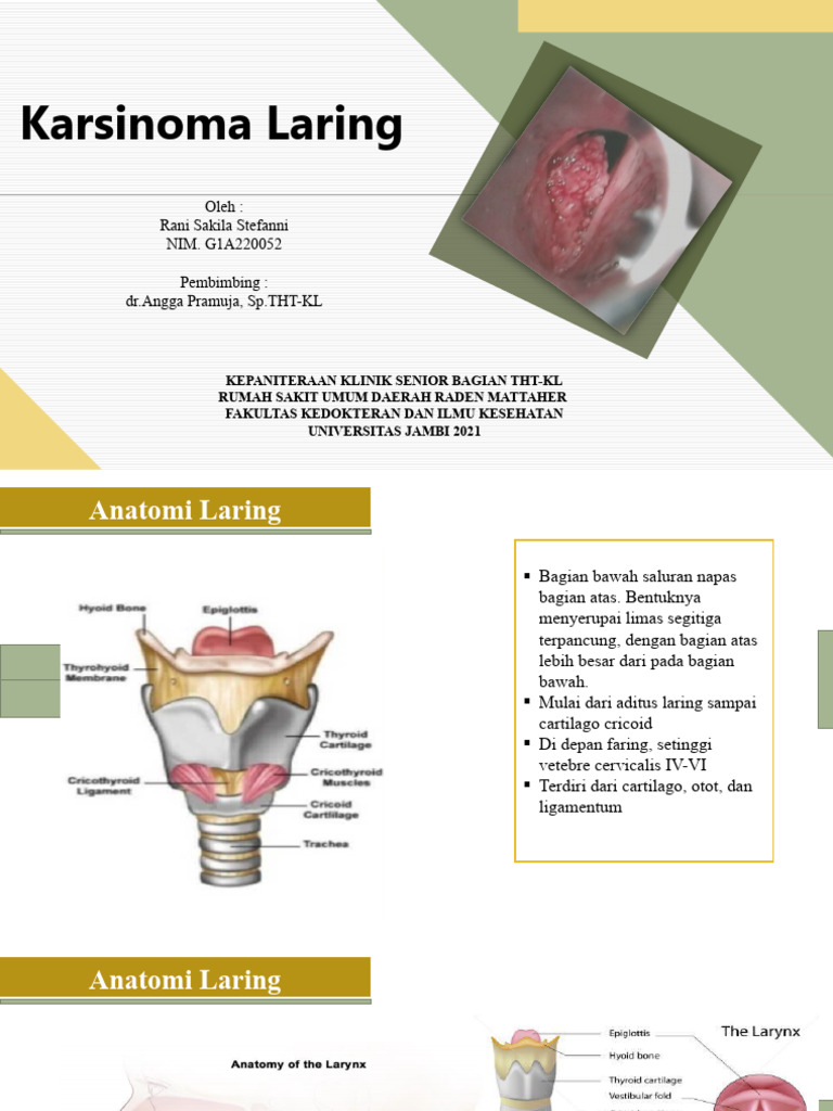 Karsinoma Laring - Rani Sakila Stefanni - G1A220052 - CRS - DR - Angga | PDF | Sains & Matematika