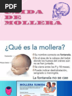 Caída de la Mollera en Bebés: Causas y Tratamiento | PDF | Cráneo