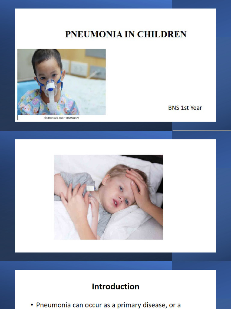 Pneumonia in Children | PDF