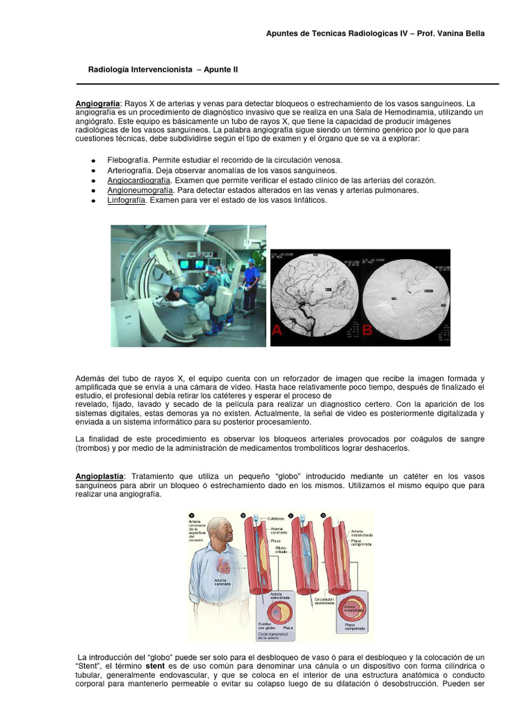 Apuntes de Tecnicas Radiologicas IV | PDF | Angiografía | Stent
