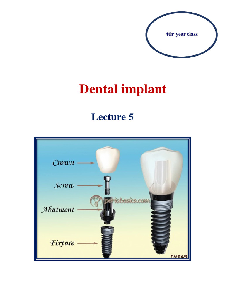 Dental Implant 5 | PDF | Dental Implant | Prosthesis