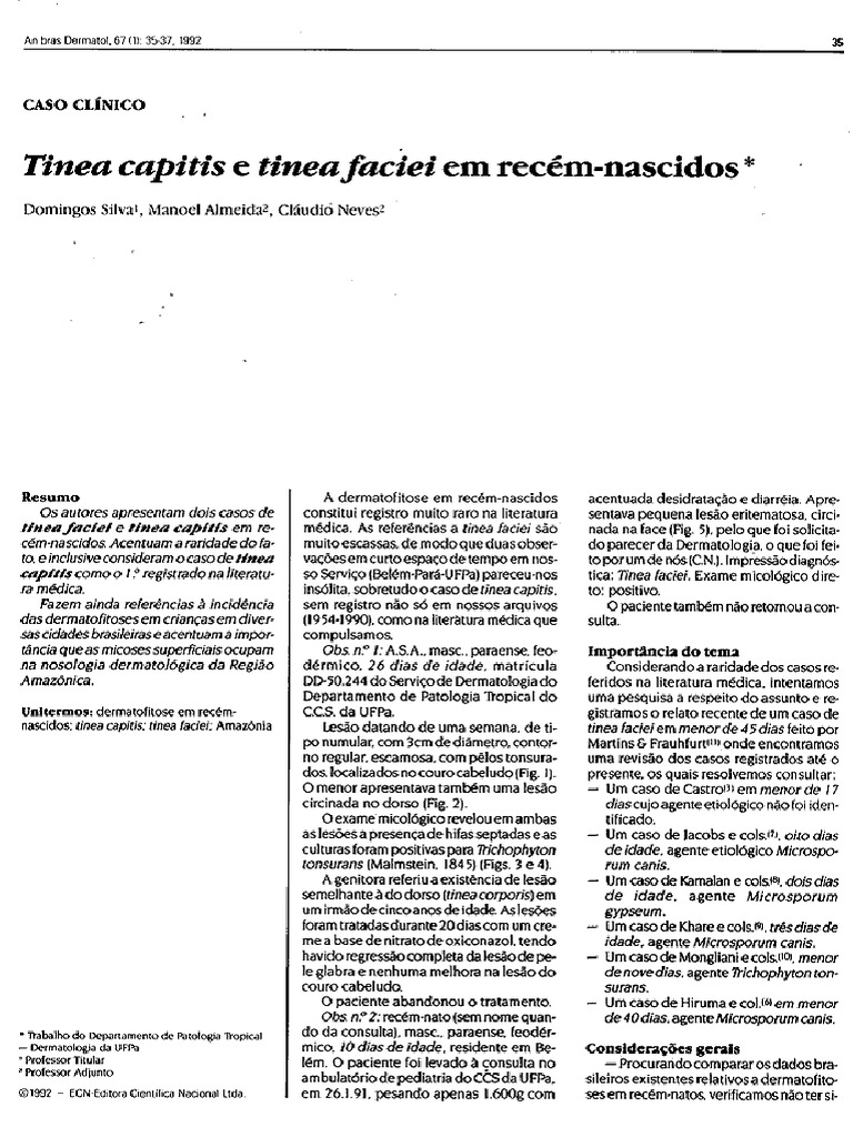 v67 Tinea Capitis e Tinea Faciei em Recem Nascidos | PDF