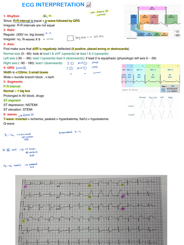ECG | PDF | Electrocardiography | Cardiovascular Physiology