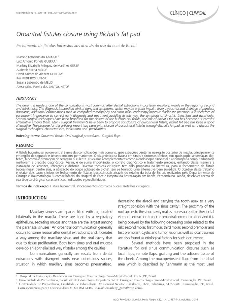 Oroantral Fistulas Closure Using Bichat's Fat Pad Fechamento de ...