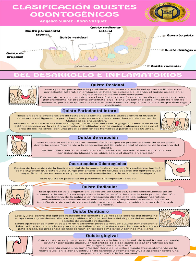 Clasificación de Quistes Odontogénicos | PDF | Diente | Boca