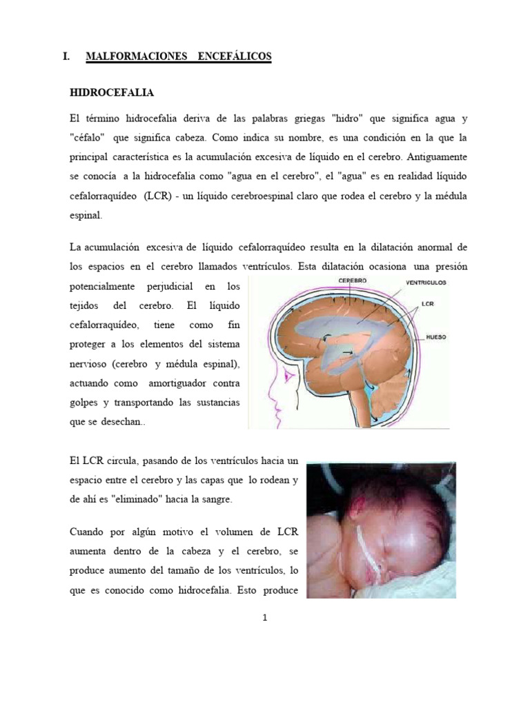 Lista de Malformaciones Congénitas | PDF | Desorden congenito ...