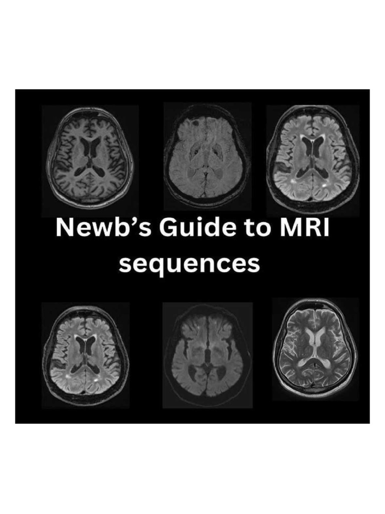 Mri Sequence Guide ?? 1688847763 | PDF