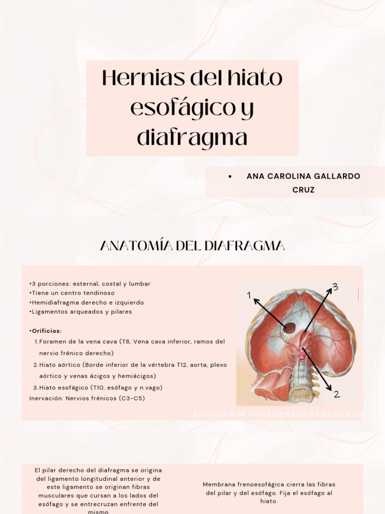 Hernias Del Hiato Esofágico y Diafragma | PDF | La enfermedad por ...