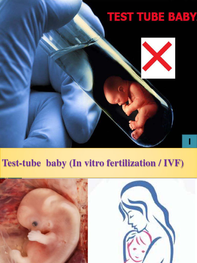 Test Tube Baby 1 | Download Free PDF | In Vitro Fertilisation | Infertility