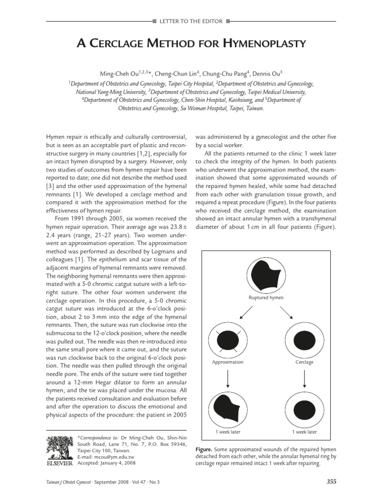 A Cerclage Method For Hymenoplasty | PDF | Gynaecology | Surgical Suture