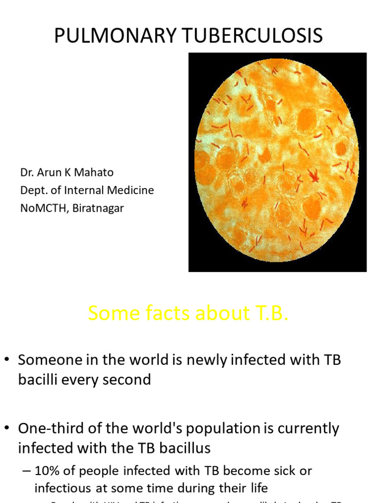Pulmonary Tuberculosis: Dr. Arun K Mahato Dept. of Internal Medicine ...