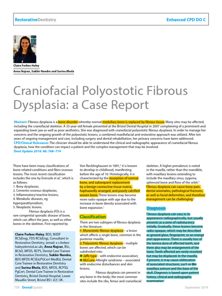Craniofacial Polyostotic Fibrous | PDF | Dental Implant | Dentures