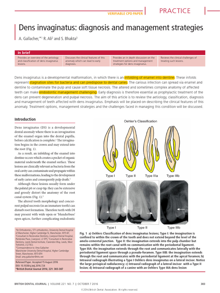 Dens Invaginatus | PDF | Human Tooth | Dental Anatomy