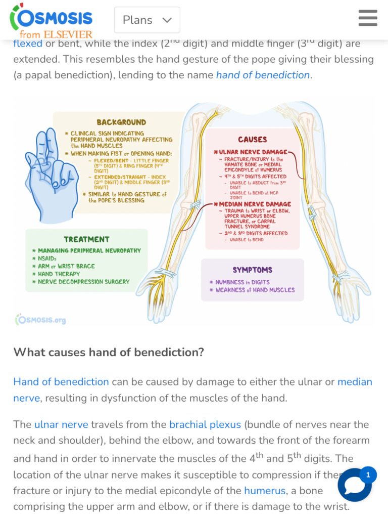 Hand of Benediction What Is It, Causes, and More Osmosis | PDF | Hand ...