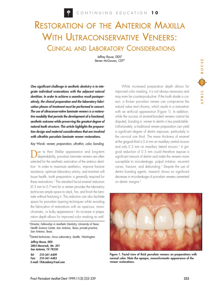 Ultraconservative Porcelain Veneers Guide | PDF | Light | Tooth