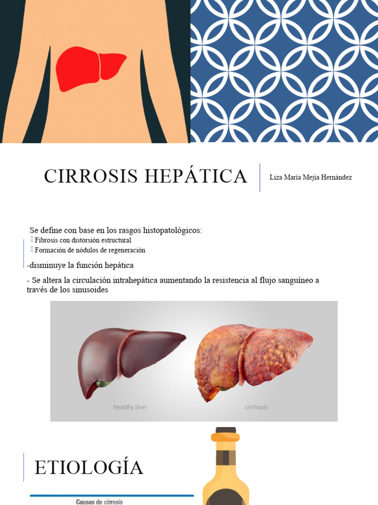 Cirrosis Hepática | PDF | Cirrosis | Especialidades Medicas