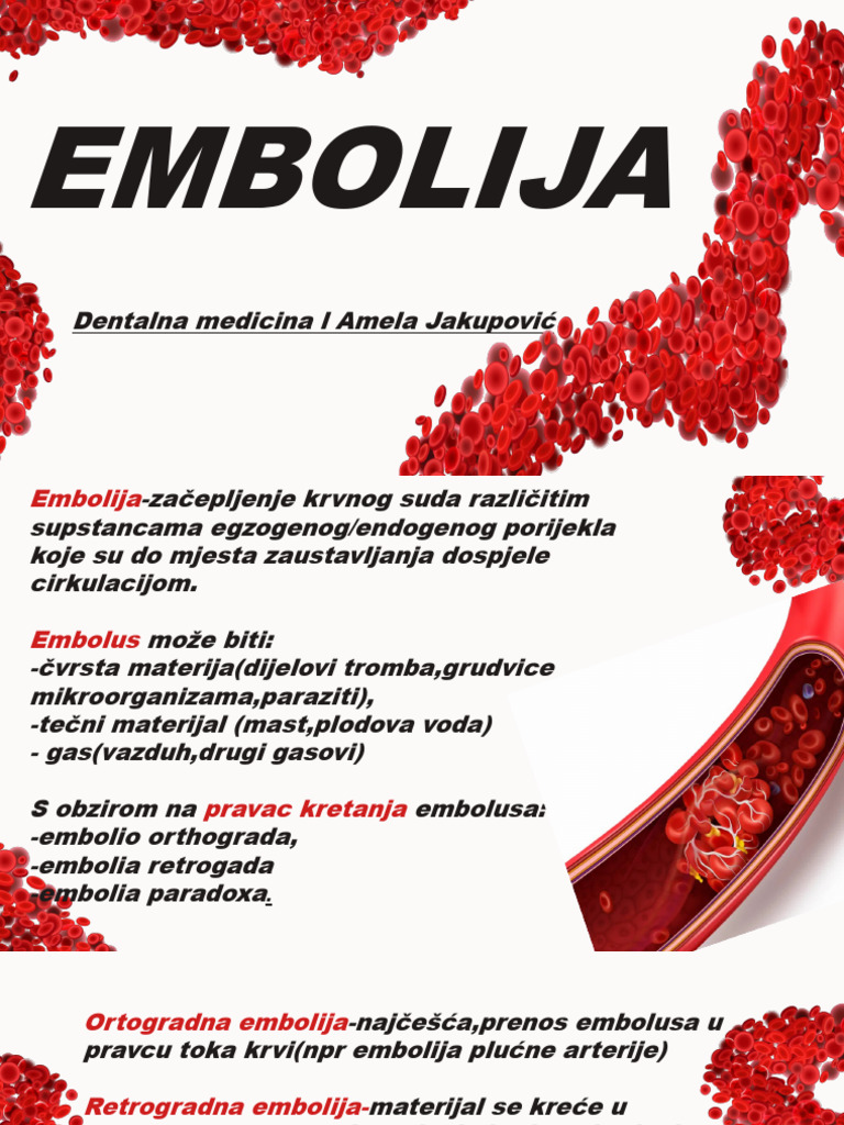 Embolija Seminar | PDF