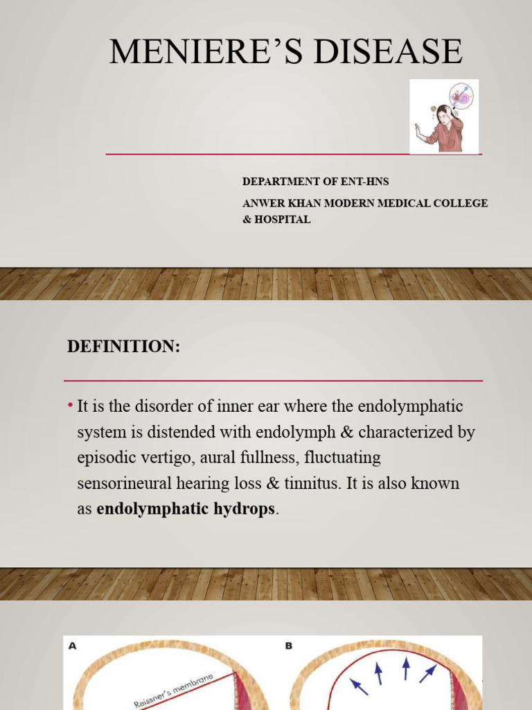 Meniere's Disease 2 | PDF | Vertigo | Ménière's Disease