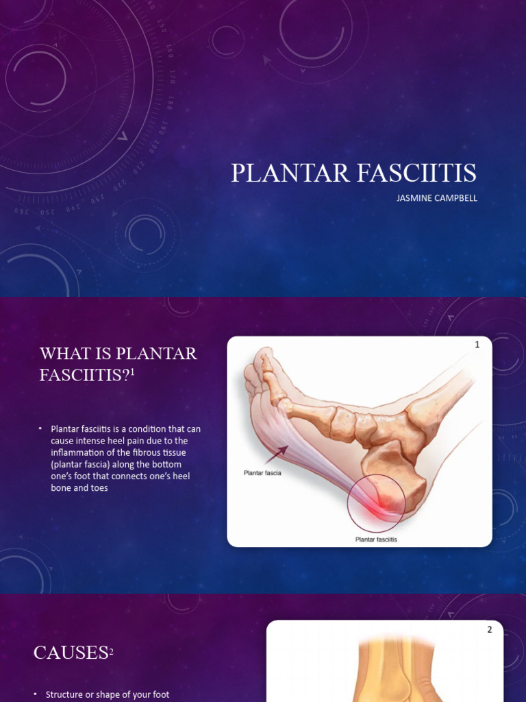 Plantar Fasciitis | PDF | Foot | Musculoskeletal System