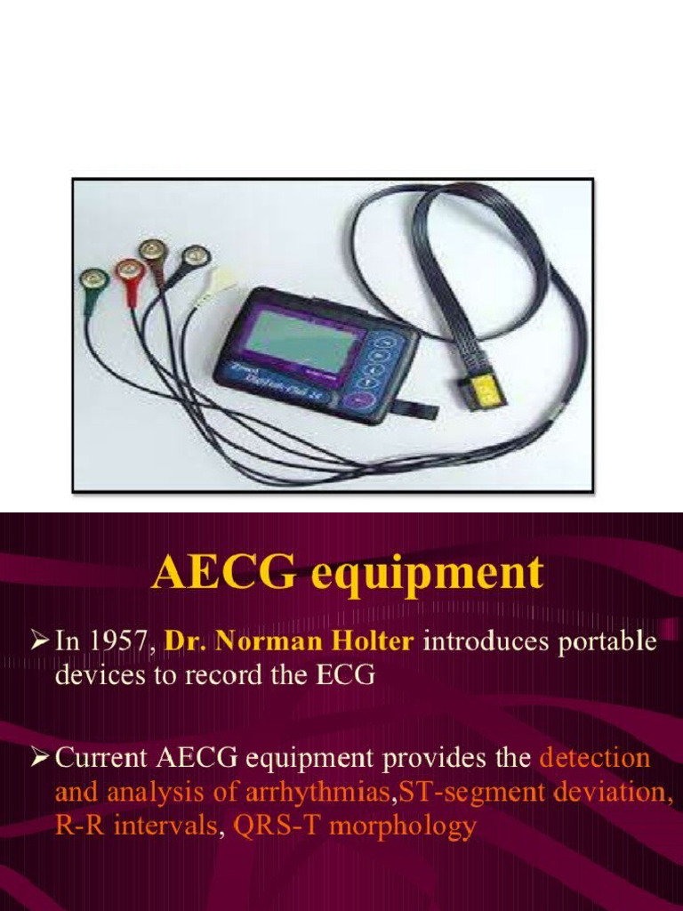 Holter 1 | PDF
