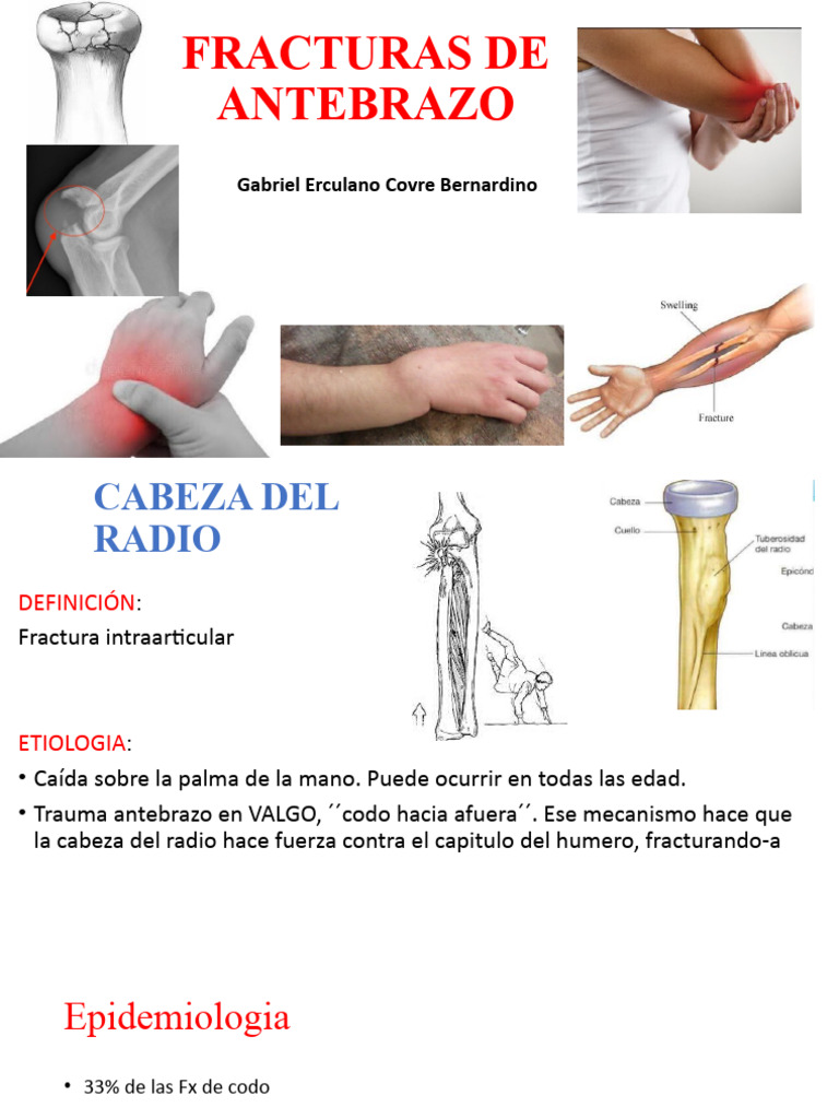Grupo 2 Fracturas De Antebrazo Pdf Sistema Musculoesquelético