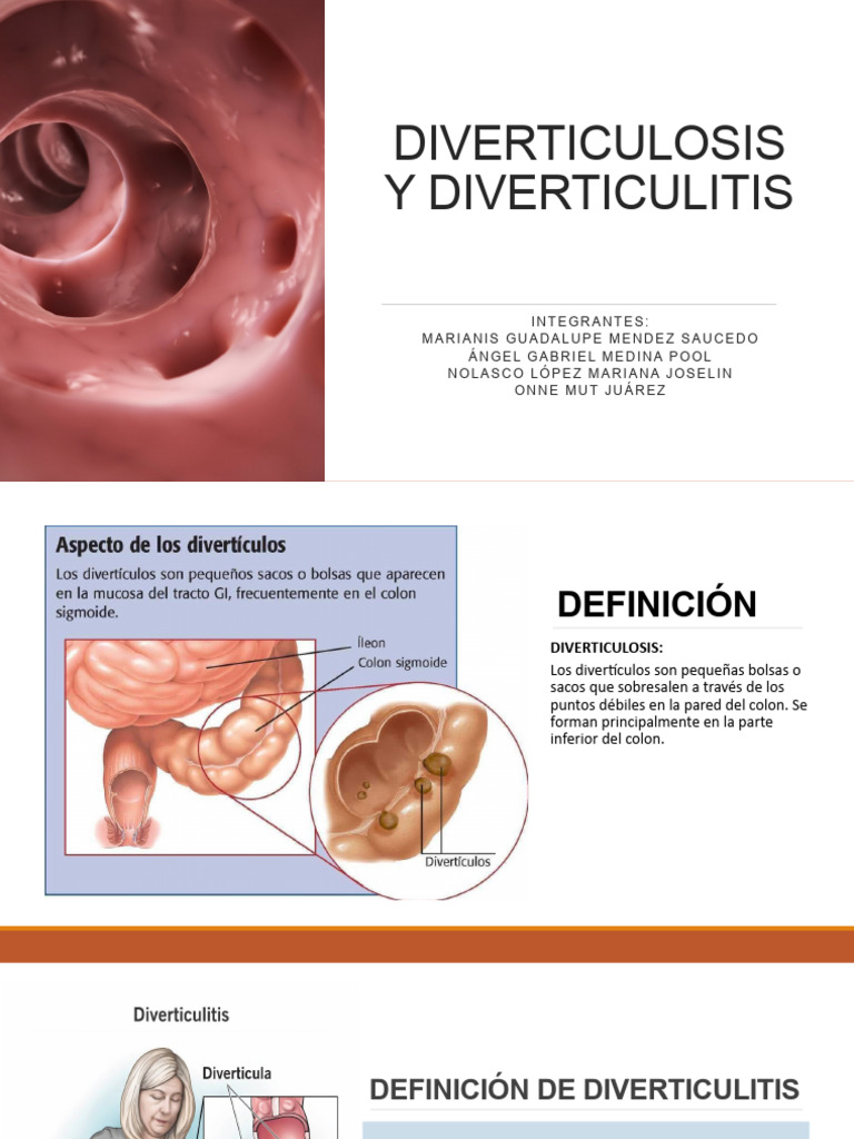 Diverticulosis y Diverticulitis Definitivo | PDF | Enfermedades digestivas | Causas de la muerte