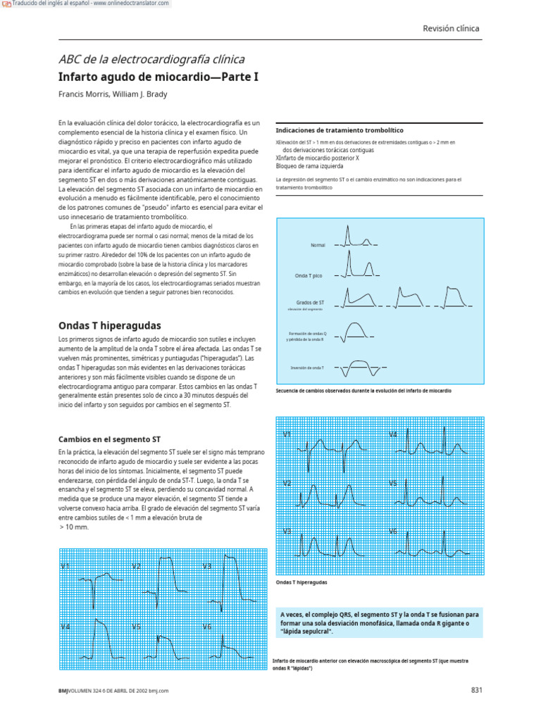 ABC of Clinical Electrocardiography Acute Myocardial Infarction-Part I ...