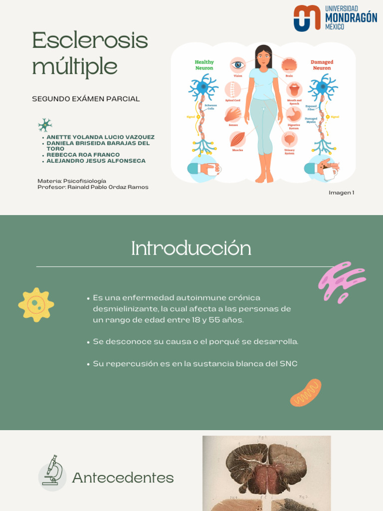 Esclerosis Múltiple: Diagnóstico y Tratamiento | PDF | Esclerosis ...