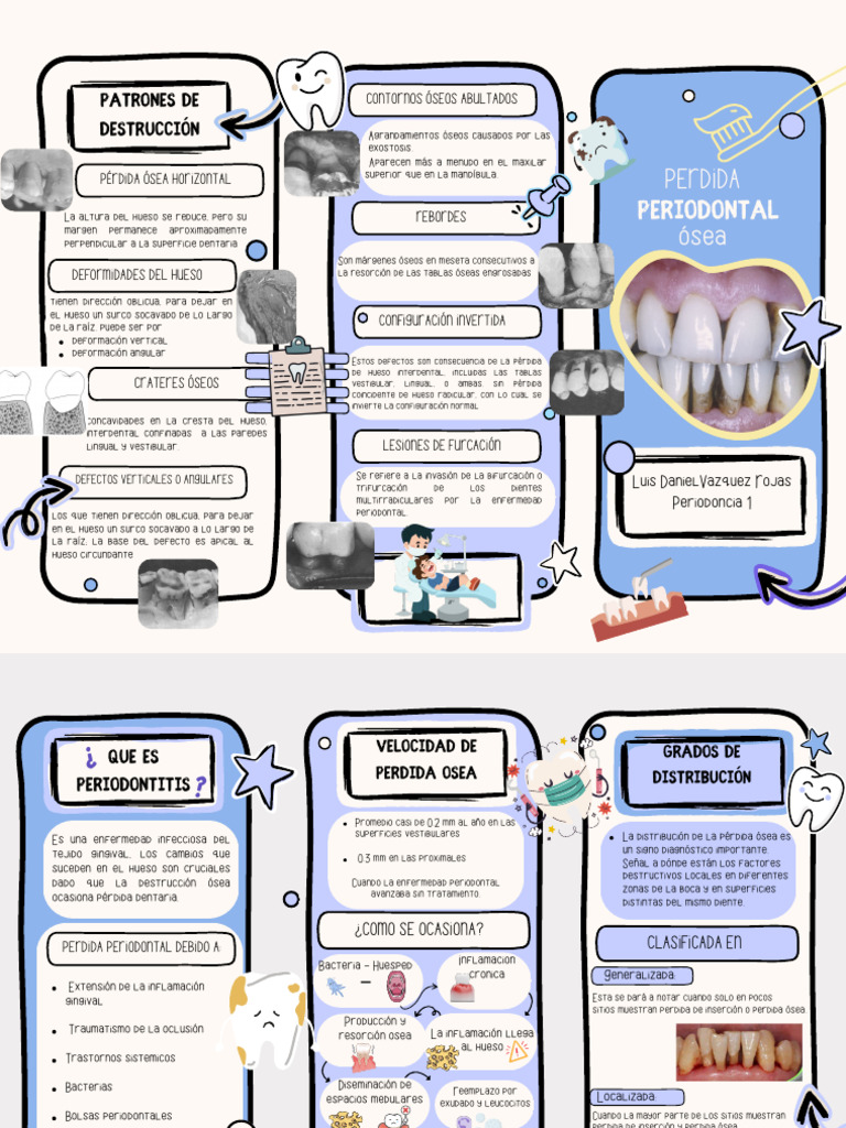 Defectos Óseos en Periodoncia | PDF | Hueso | Diente