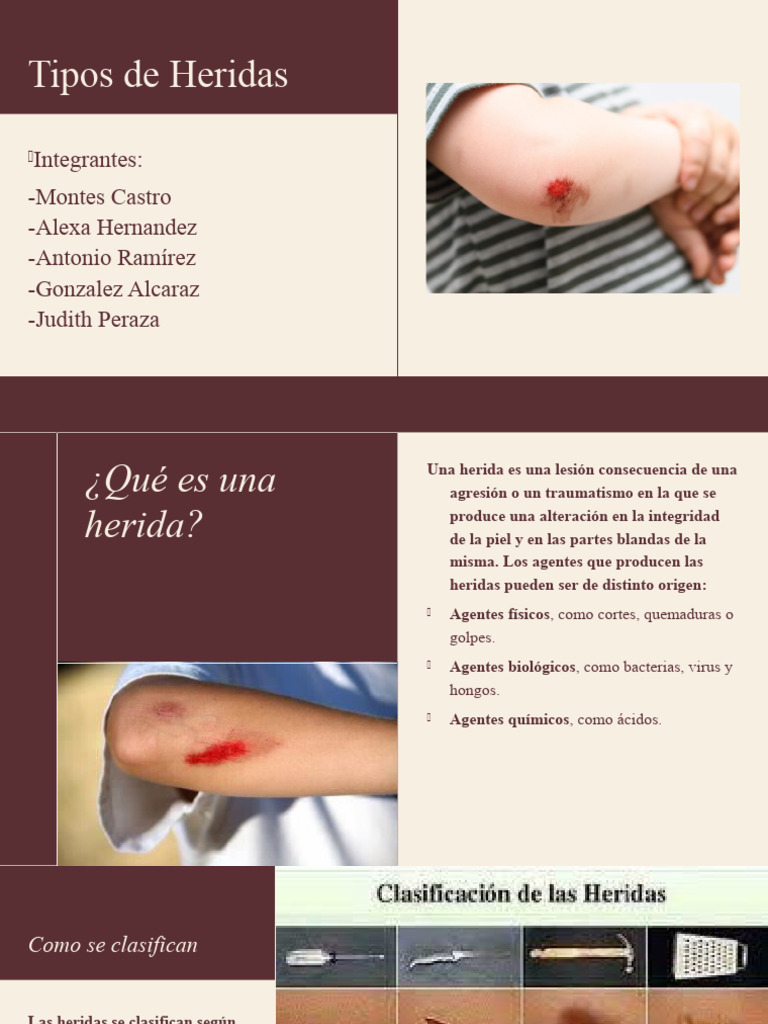 Guía Completa de Tipos de Heridas | PDF | Herida | Especialidades Medicas