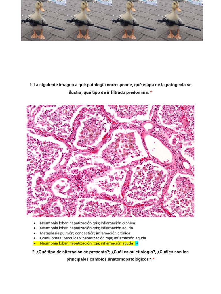 Pato Tactico | PDF | Inflamación | Isquemia