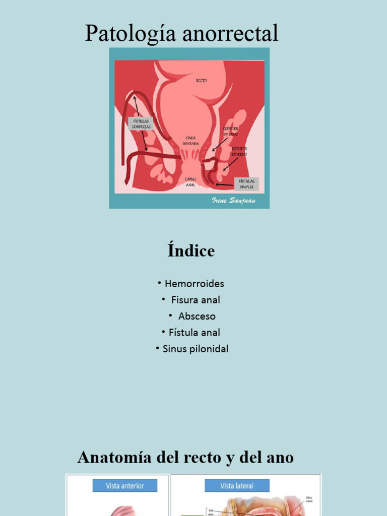 Patología Anorrectal | PDF | Hemorroides | Enfermedades y trastornos