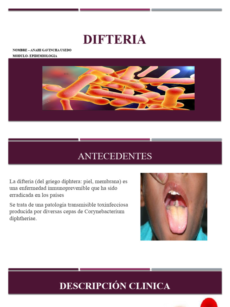 Difteria: Epidemiología y Diagnóstico | PDF | Causas de la muerte ...
