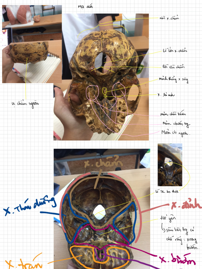GTNH Gorge Overview | PDF