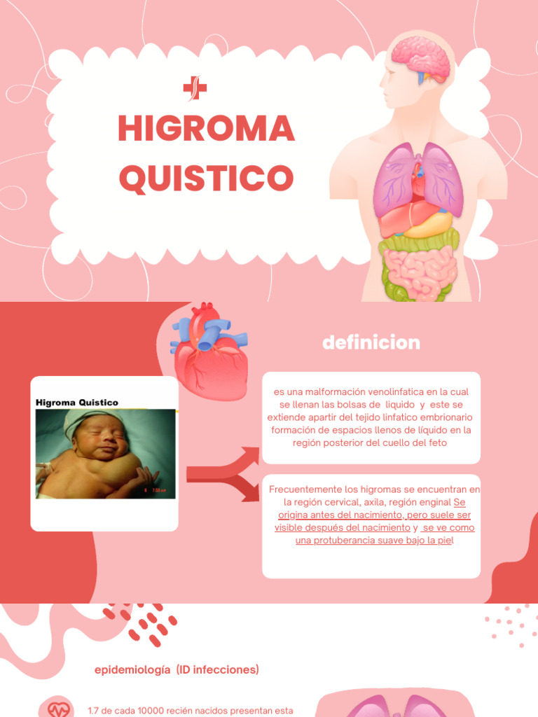 Higroma Quístico: Definición y Tratamiento | PDF | Especialidades ...