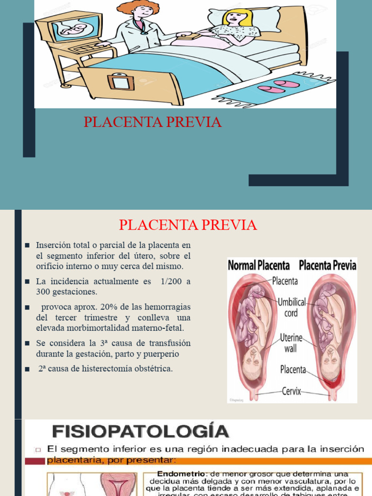 Placenta Previa Exponer | PDF | El embarazo | Especialidades Medicas