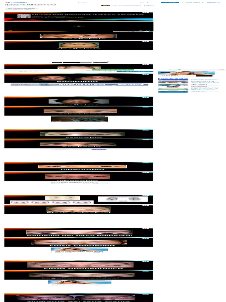 signos en Oftalmologia PPT 2 | PDF | Oftalmología | Ojo humano