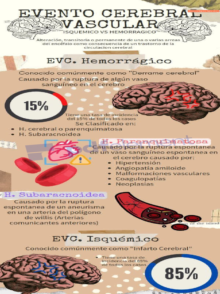 EVC (Evento Cerebral Vascular) | PDF
