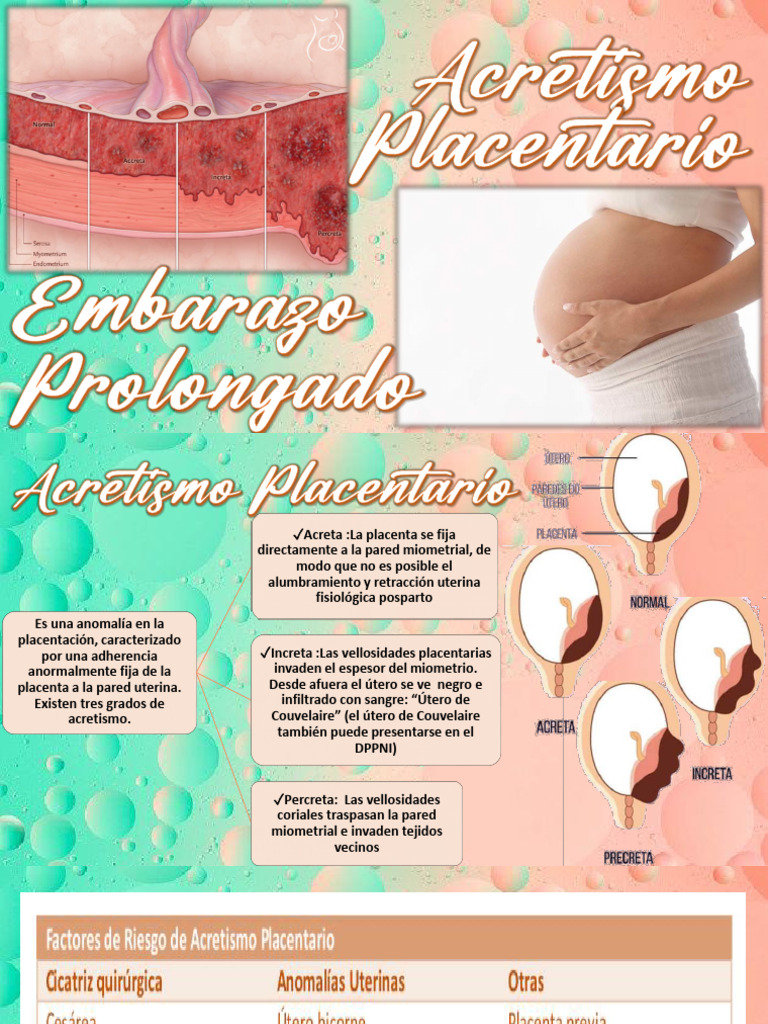 Acretismo Placentario | Descargar gratis PDF | El embarazo ...