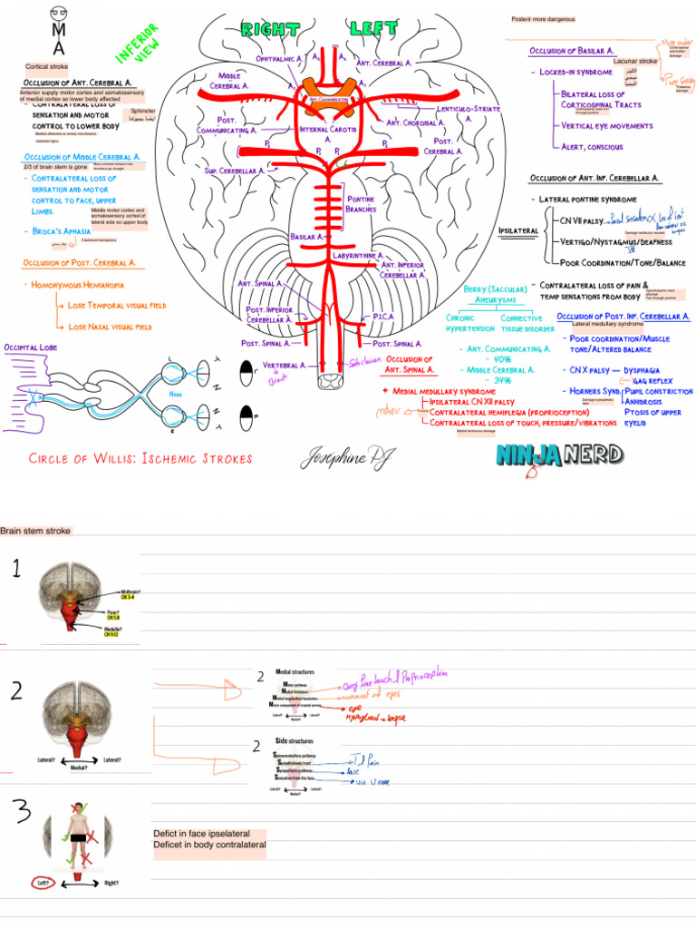 Circulatory System) Circle of Willis - Ischemic Strokes - Key | PDF