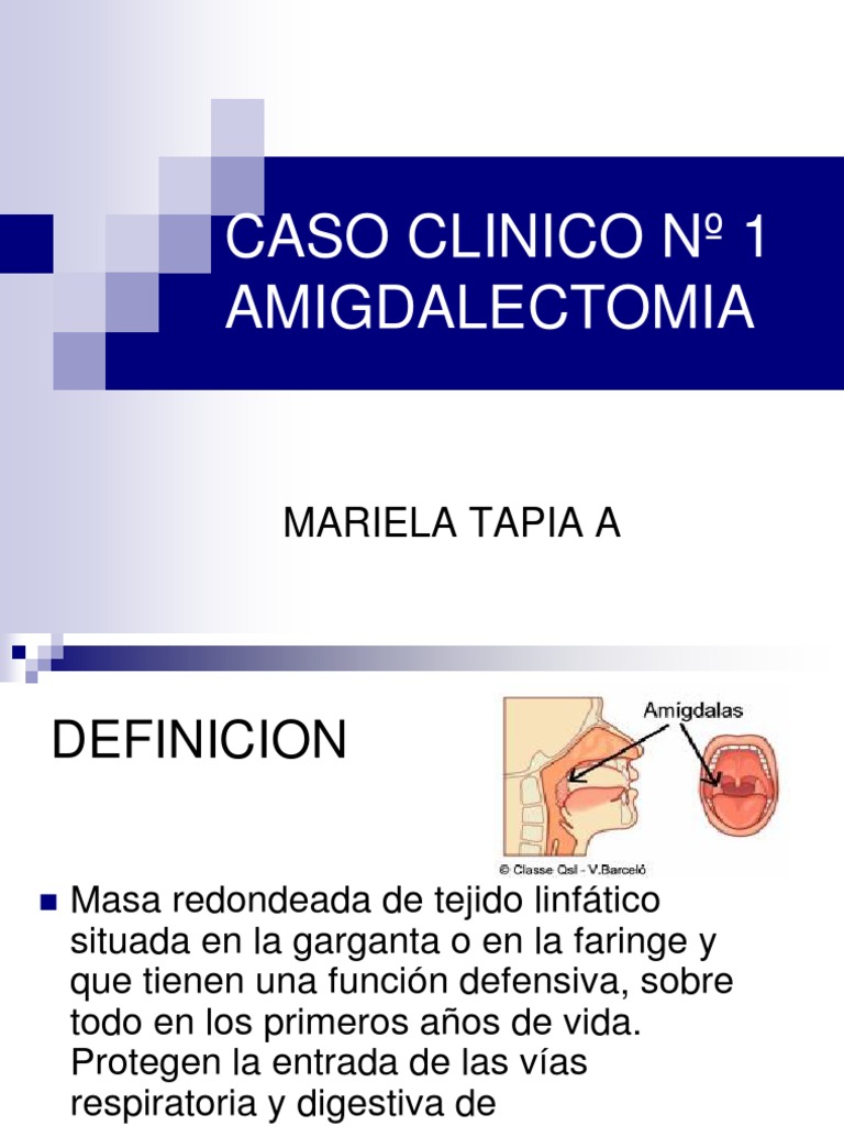 CASO CLINICO Nº 1.ppt AMIGDALECTOMIA | Inmunología | Ciencias de la Salud
