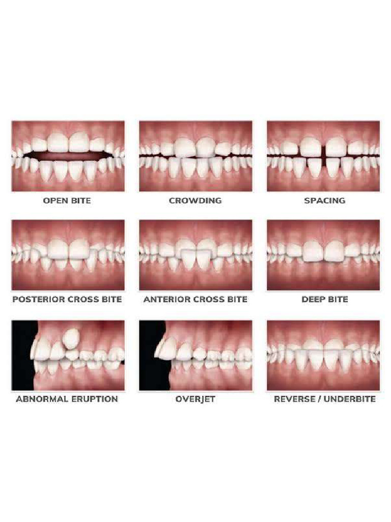 Dental Bit | PDF